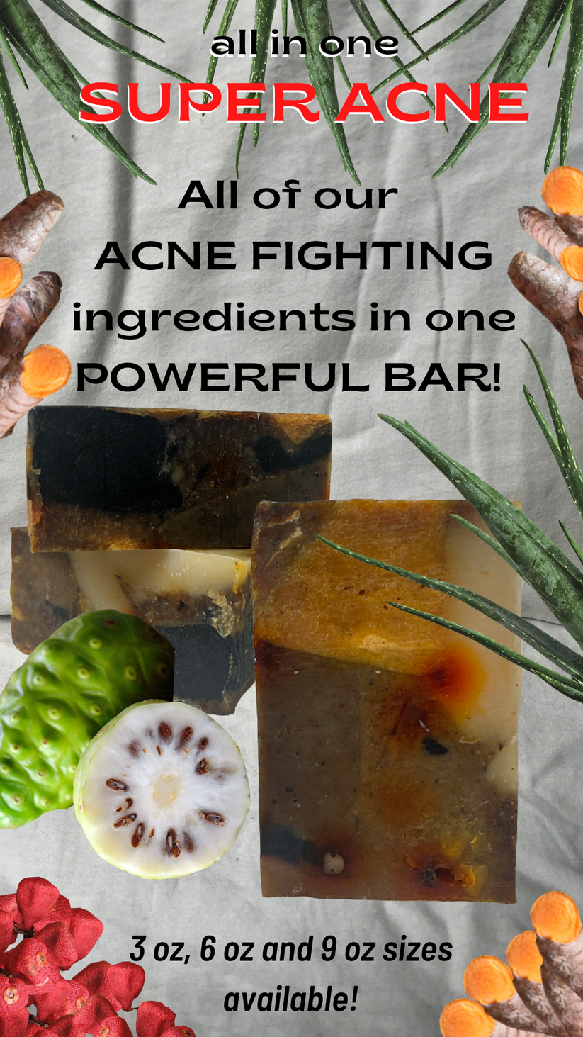 All in One Super Acne Soap – Blessings All Natural (Jamaica Wholesale)