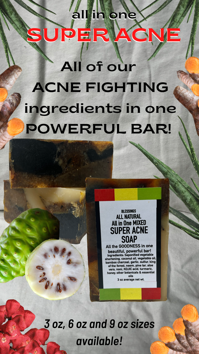 All in One Super Acne Soap – Blessings All Natural (Jamaica Wholesale)