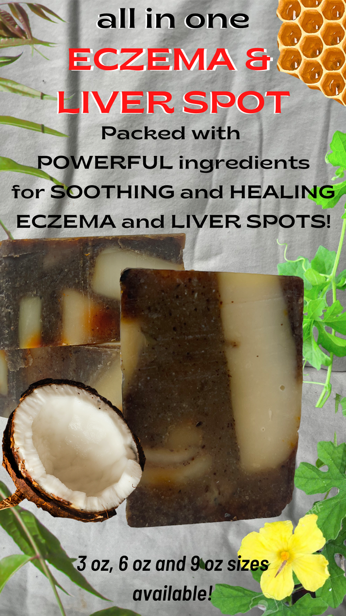 All in One Super Liver Spot & Eczema Soap – Blessings All Natural ...